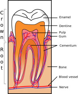 Cracked Tooth Syndrome Symptoms and Causes | Putney Dental Care